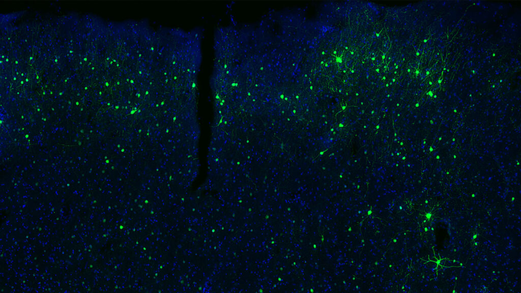 Modified, harmless viruses that light up neurons in glowing color could ...