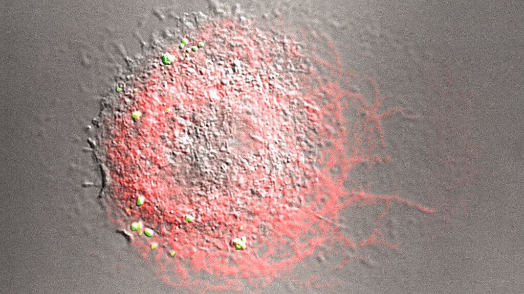 SciShots: Tracking immune cells’ digestion - Allen Institute