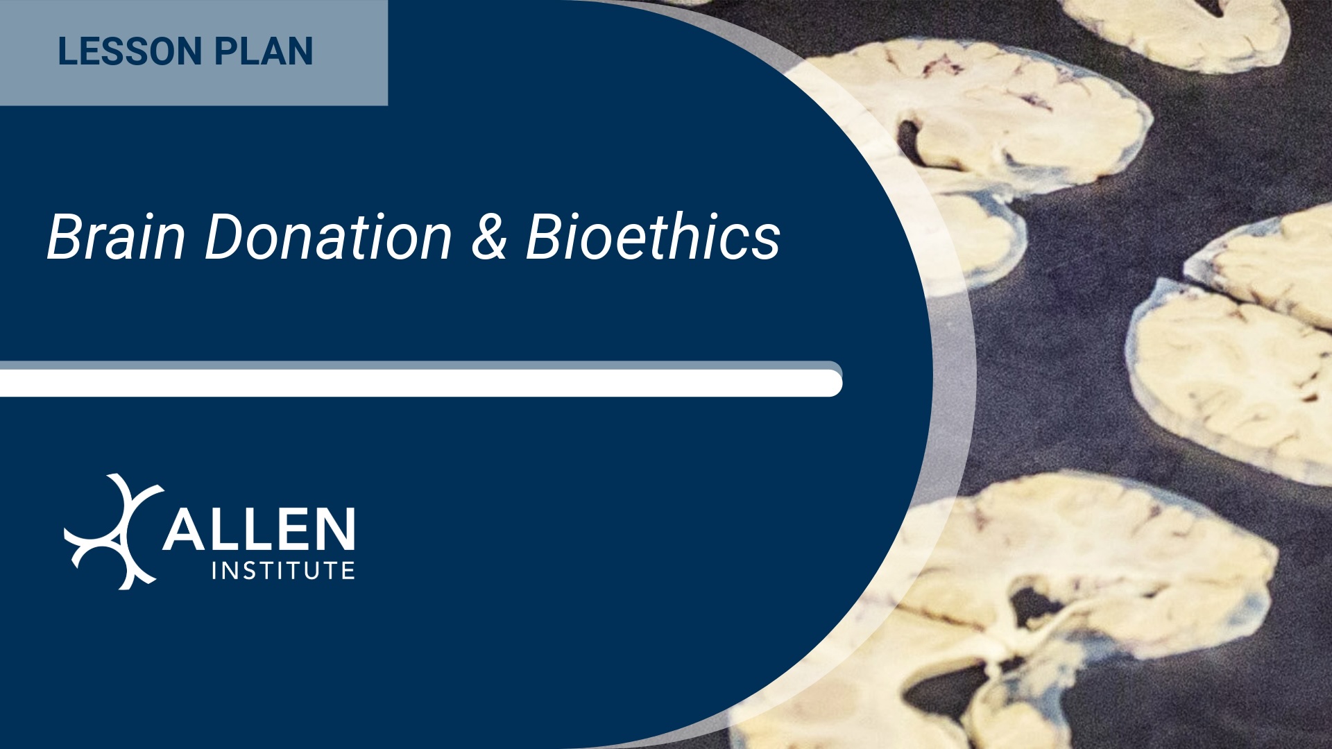 Brain Donation & Bioethics - Allen Institute