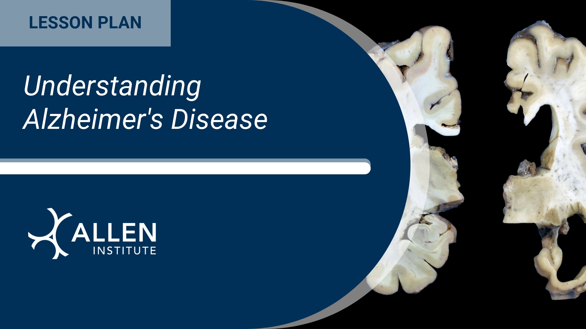 Understanding Alzheimer’s Disease - Allen Institute