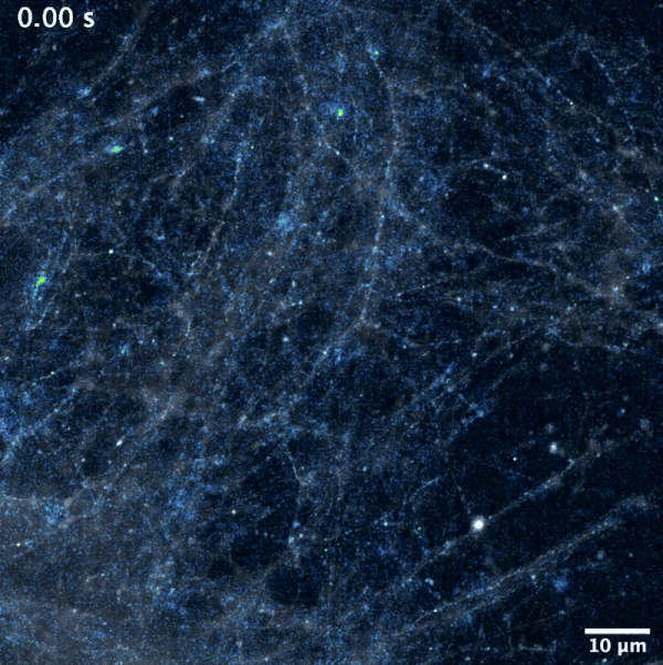 Scientists develop new way to “listen in” on the brain’s hidden ...